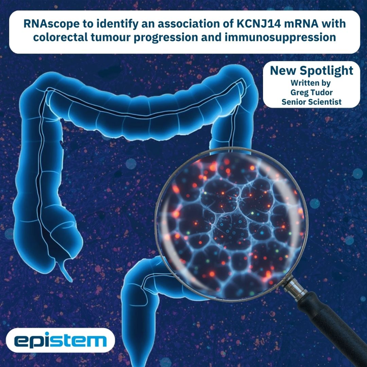 Spotlight: The use of RNAscope to identify an association of KCNJ14 ...